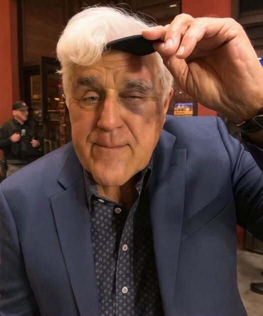 Jay Leno, 74, Shares Latest Update with Fans - Dogrupara News